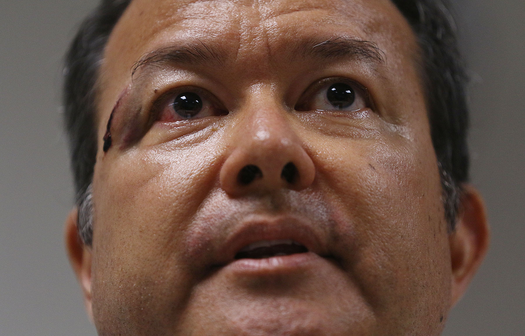 Tom Brower to Press Charges Against Homeless Teens in Kakaako ...