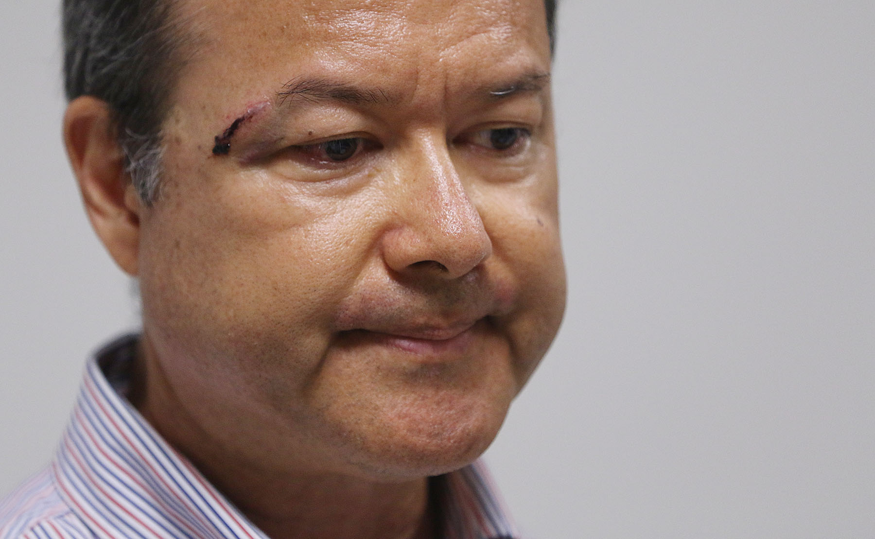 Brower Tempest Obscures Real Issues in Kakaako - Honolulu Civil Beat