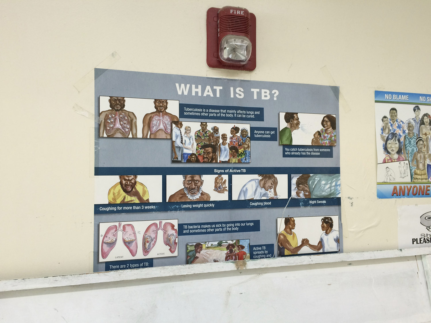 TB Program For Marshall Islands - Honolulu Civil Beat